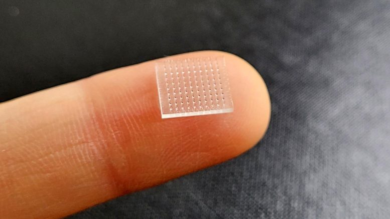 Painless Tattoos Developed – Easy, Do-It-Yourself Microneedle Patches