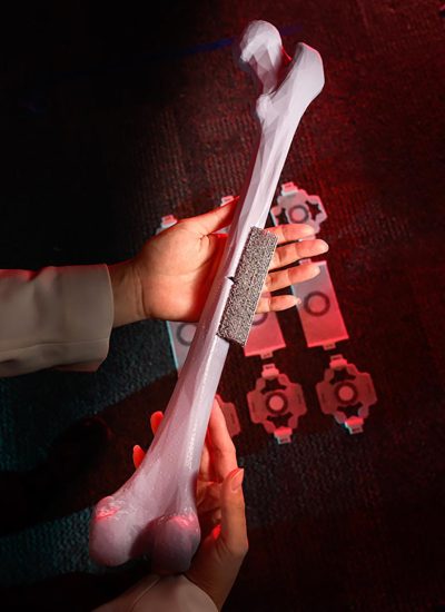 Synthetic Bones Designed by AI Set to Transform Orthopedic Surgery