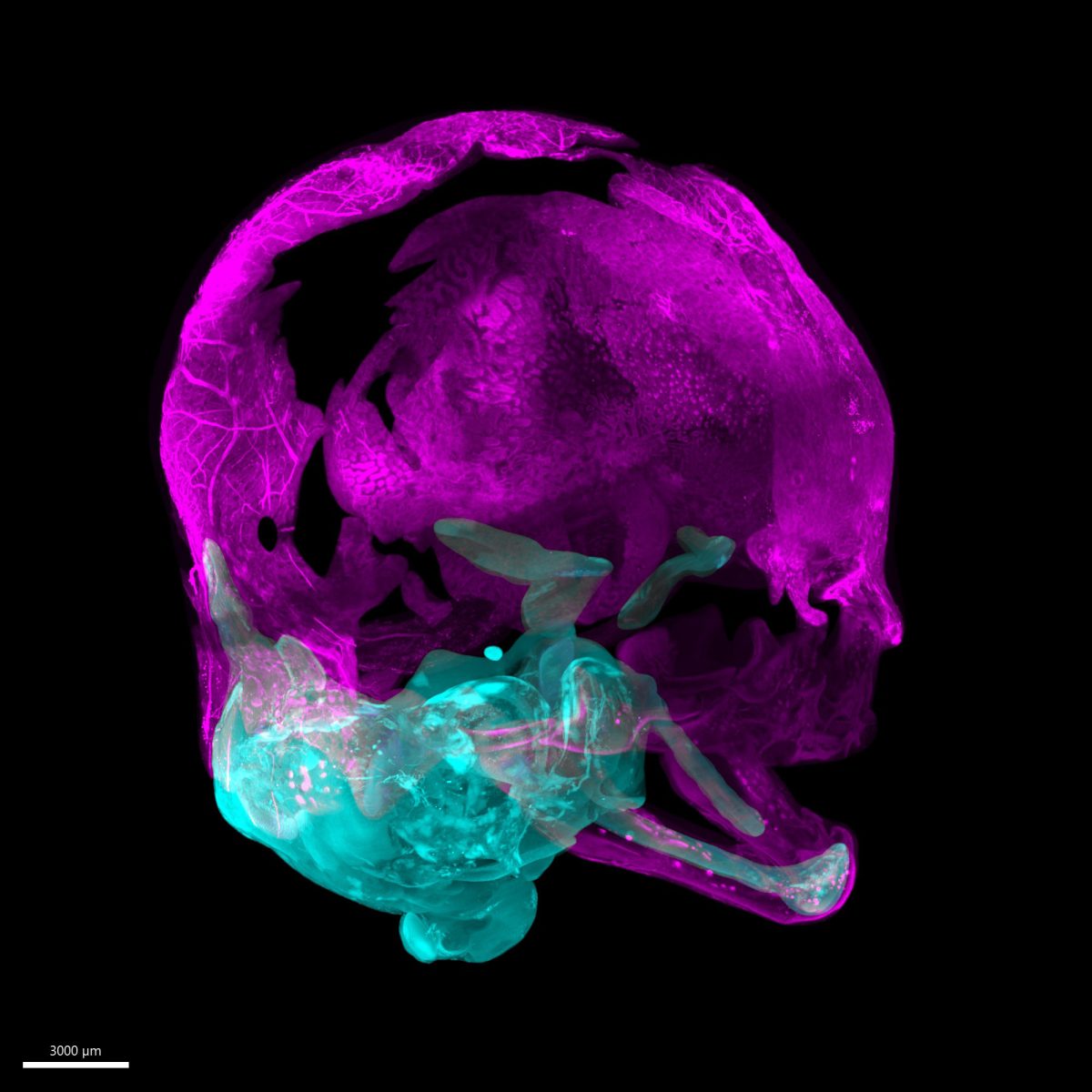 First Complete Map of Human Skeleton Formation Could Transform Bone ...