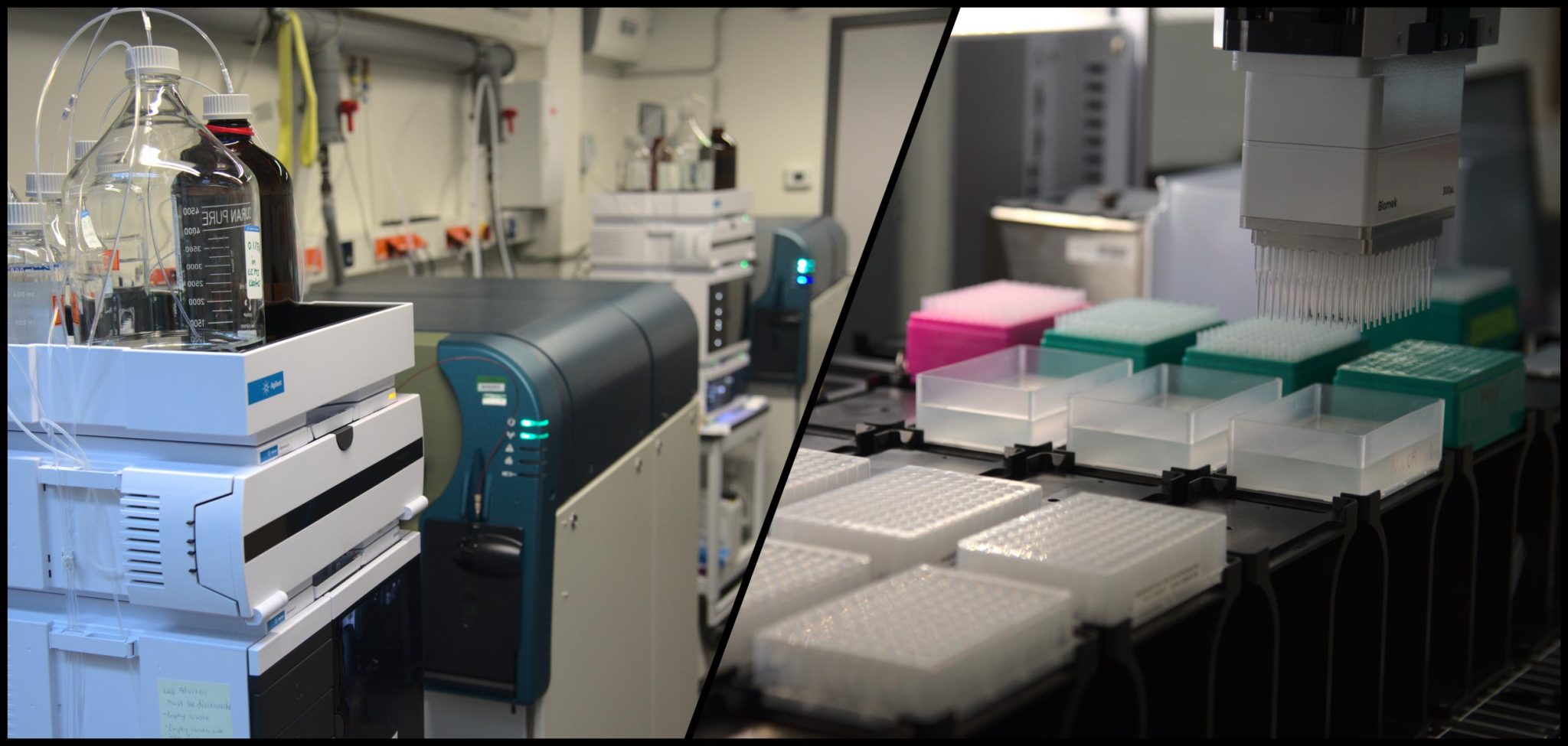 Machine Learning AI Can Predict COVID-19 Survival From Single Blood Test