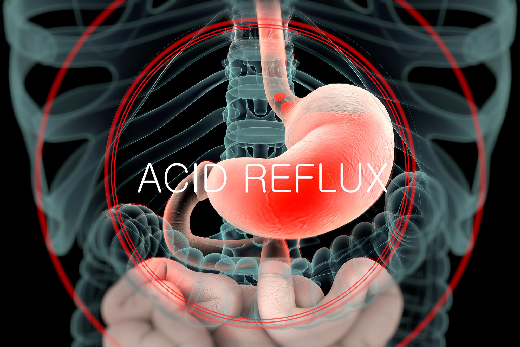 New Study Reveals a Hidden Risk in Acid Reflux Medications