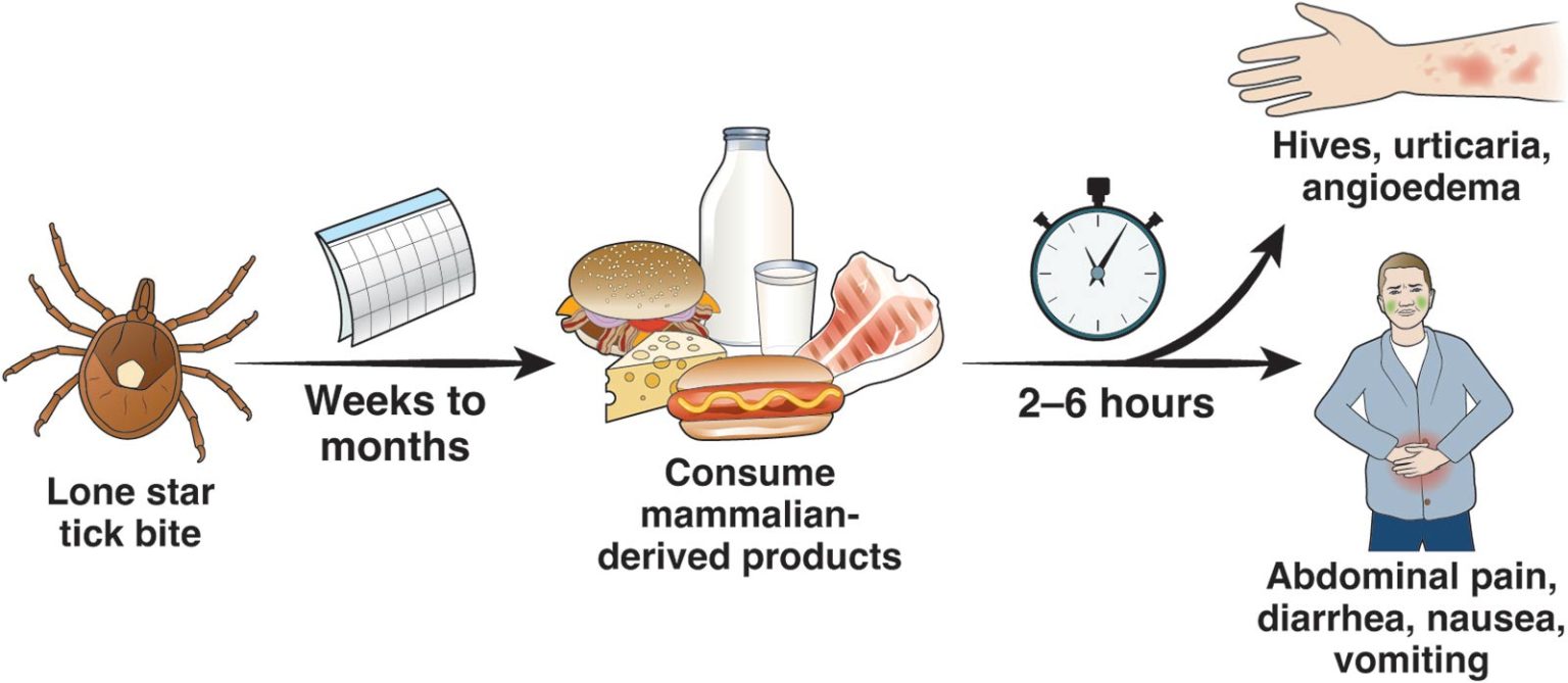 Unexplained Digestive Problems? Lone Star Tick Bites May Be To Blame
