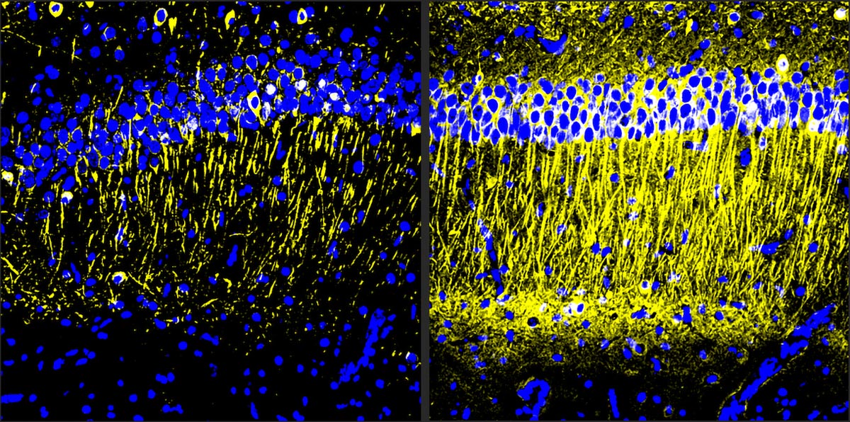 Alzheimer: molecola A11 riduce l'infiammazione e migliora la memoria ...