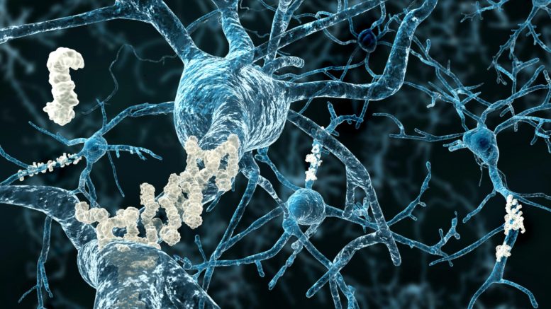 Reversing Alzheimer’s: Stem Cell Therapy Shows Promise