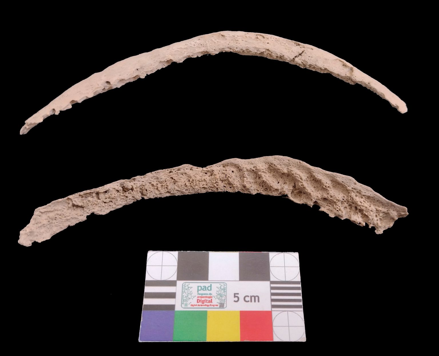 New Study Indicates That Syphilis Originated in the Americas Prior to ...