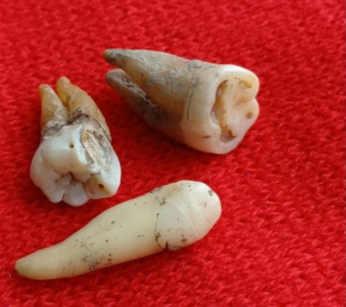 Teeth Can Preserve Antibodies For Centuries Opening Door To Study Teeth Can Preserve Antibodies For Centuries Opening Door To Study