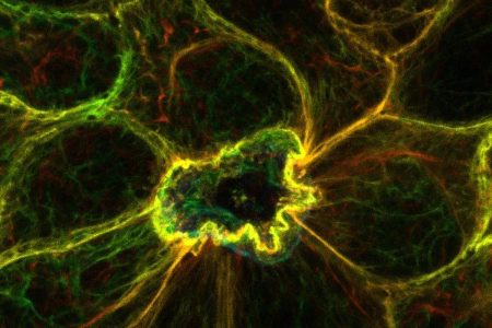 Guarding Life: How Calcium Transforms Cell Death Into Defense