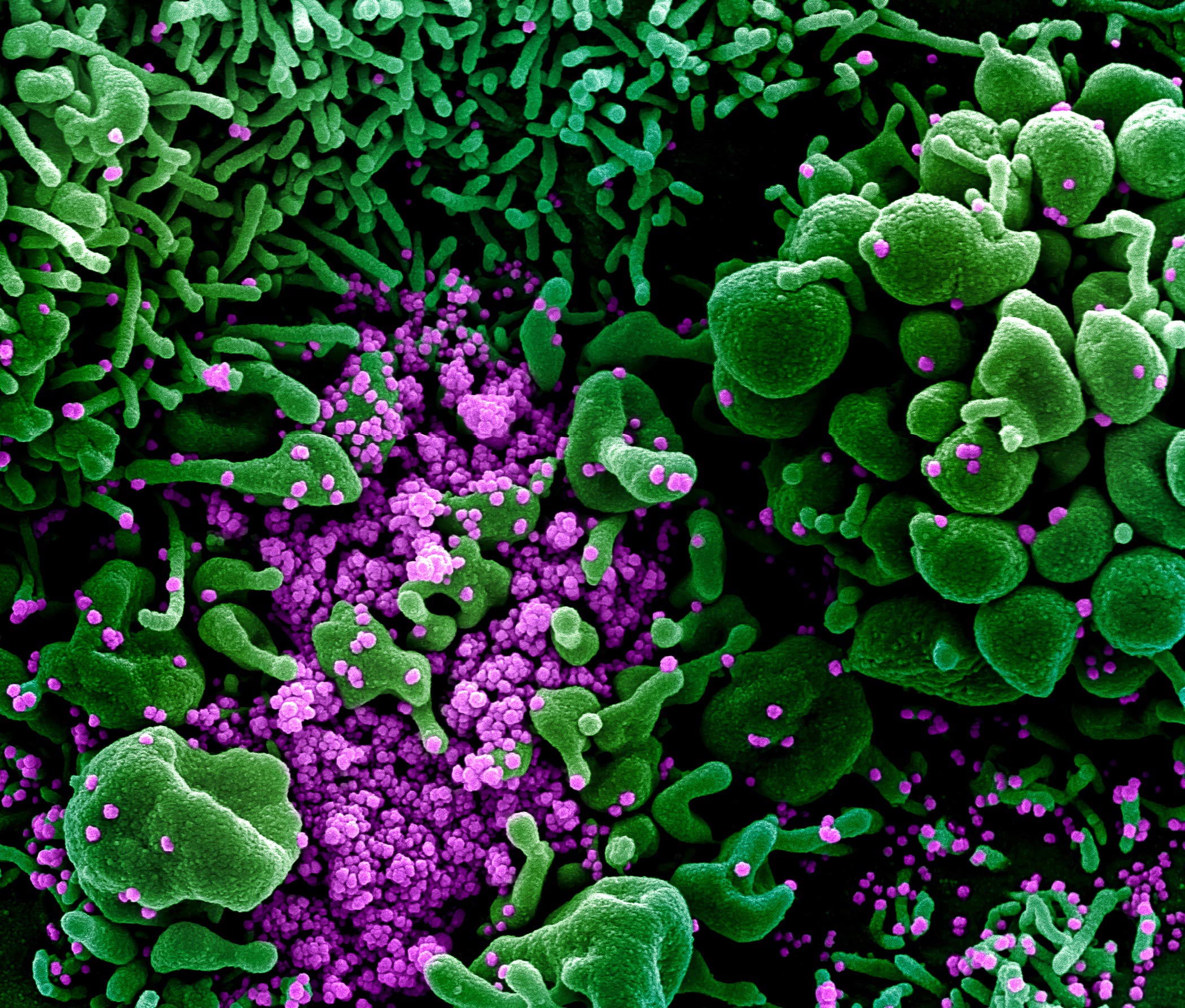 The Mucus Miracle: How Mucosal Vaccines Could Revolutionize COVID-19 Fight