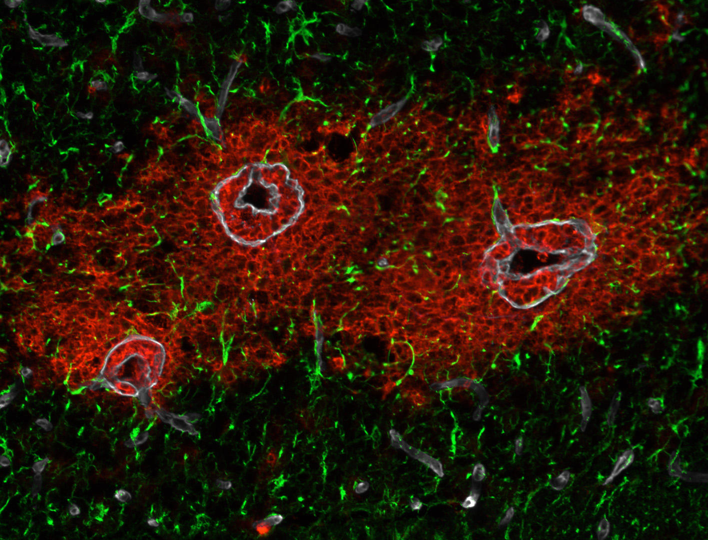 Can White Blood Cells Cross Blood Brain Barrier at Tahlia Imlay blog