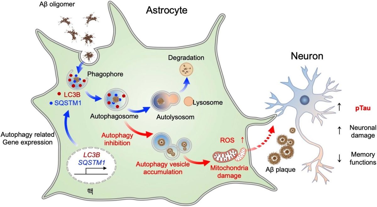 Breakthrough Alzheimer’s Discovery: Scientists Discover New Treatment Path