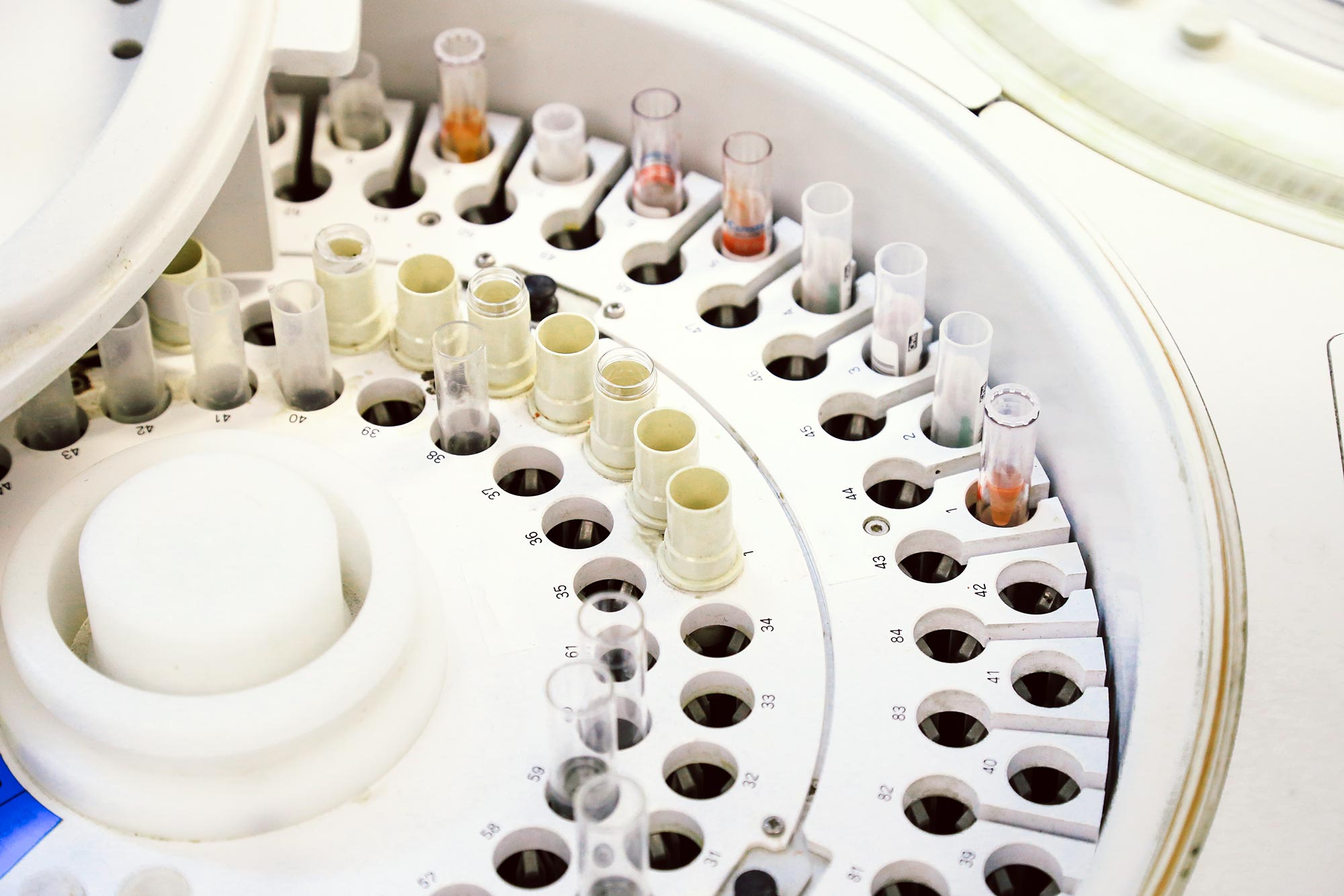 Groundbreaking Development in Rapid Large-Scale COVID-19 Testing