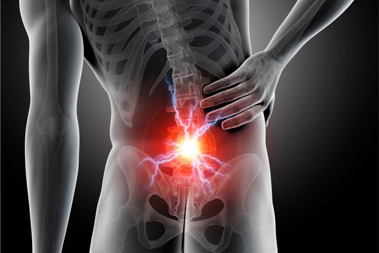 Best Medications for Treating Acute Low Back Pain According to ...