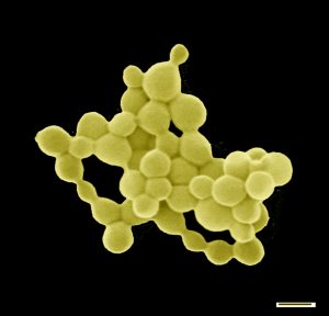 Researchers Reveal How Bacteria Can Produce Gold