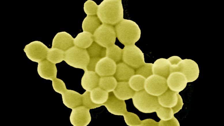 Researchers Create New Lightweight 18-Carat Gold That Weighs 5 to 10 ...
