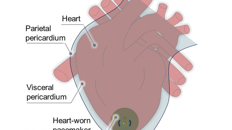 COVID Can Infect Pacemaker Cells That Maintain the Heart’s Rhythm ...