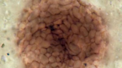 Billion-Year-Old Fossil Discovered – Reveals Missing Link in the ...
