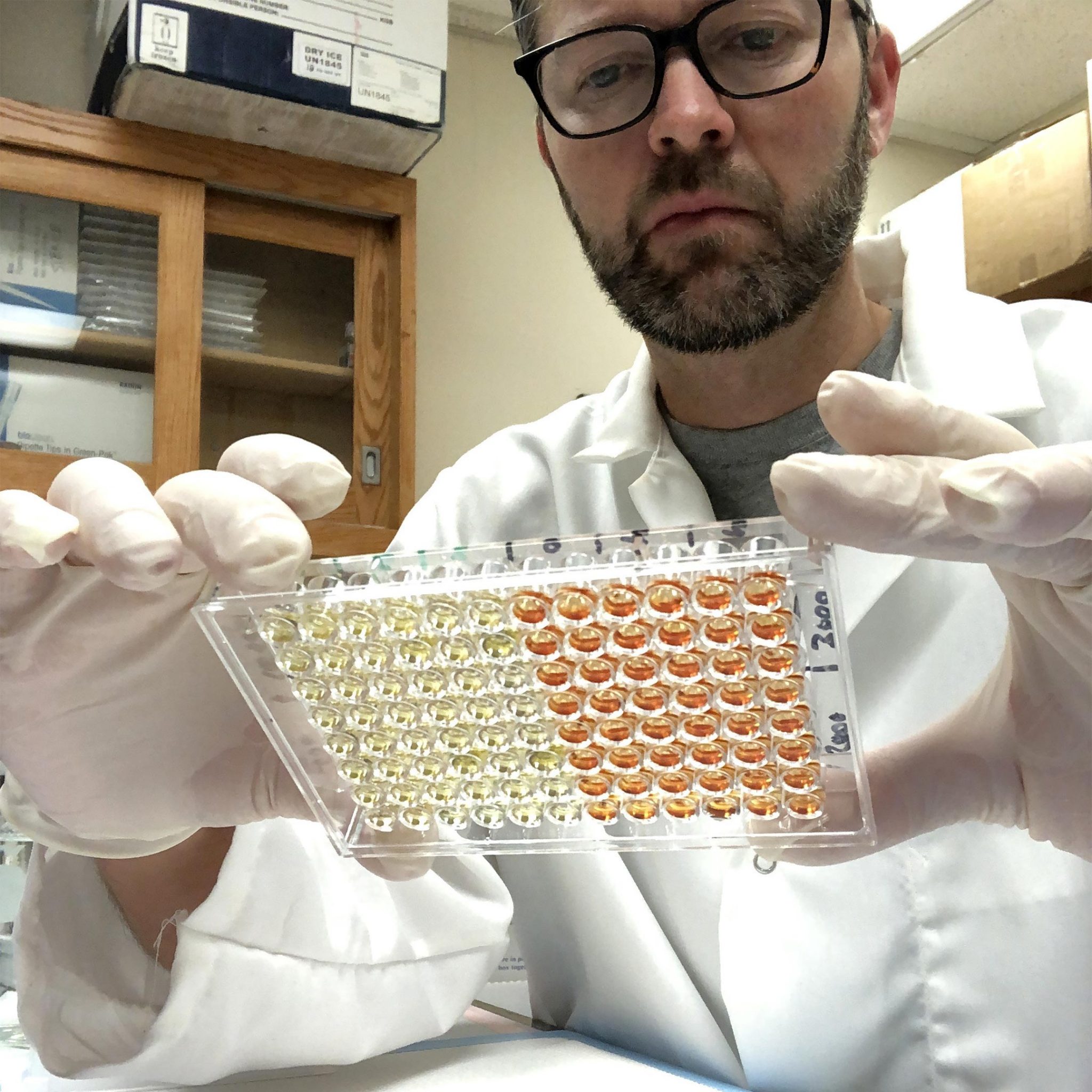 Recovering From COVID-19 Doesn’t Guarantee Antibodies or Confer ...