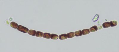 Scientists Discover a Teeming World of Life at the Ice Cap