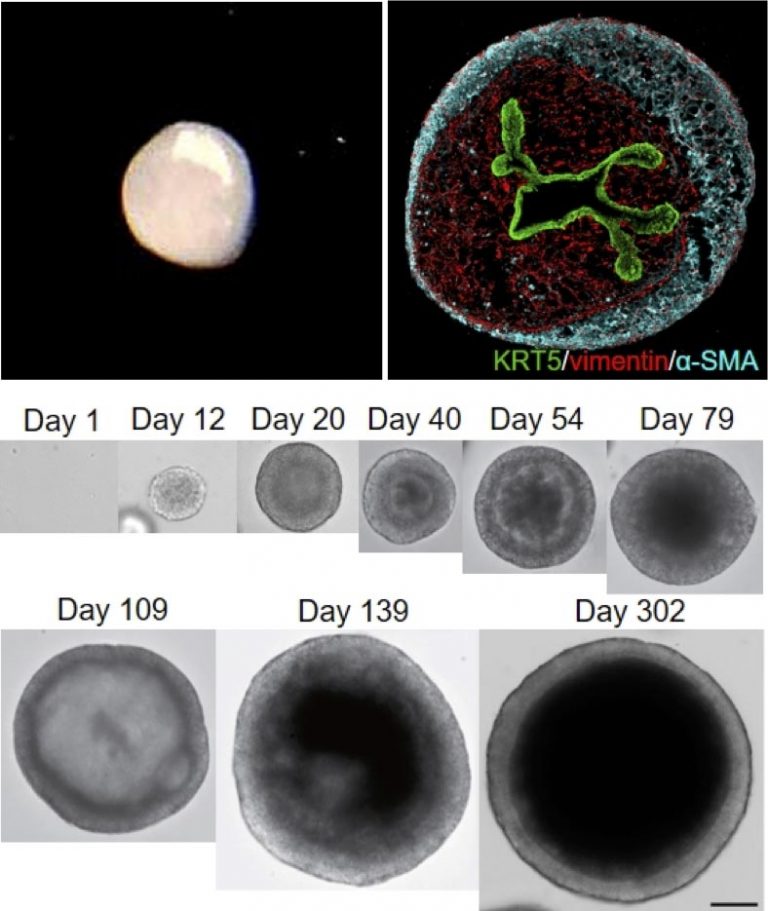 Lab-Grown Three-Dimensionally Reconstituted Organoids That Are Just ...
