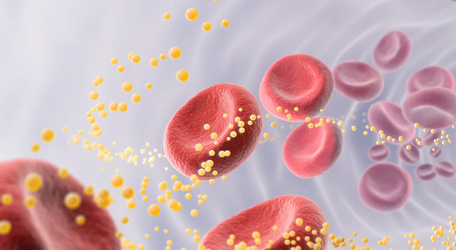 A Major Update Just Hit Cholesterol Guidelines – Here’s What Every ...