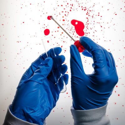 Blood Forensics Puzzle Cracked via Fluid Mechanical Principles