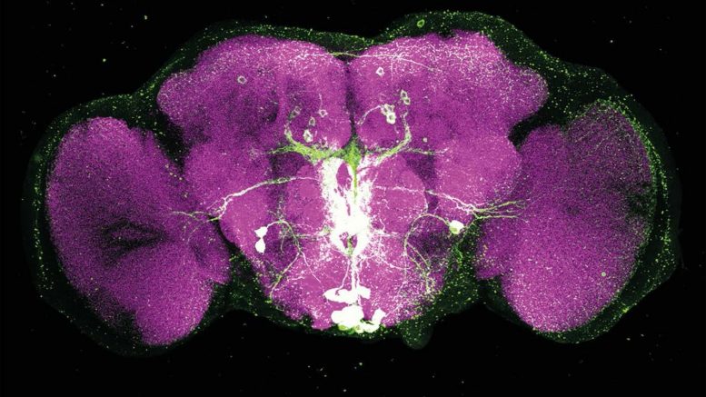 Hunger Affects Behavior and Changes Pathways in the Brain
