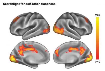 Feeling Disconnected? Loneliness Alters Your Brain’s Social Network