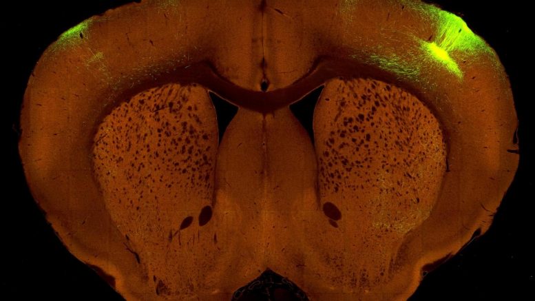 A New Complete, High-Resolution 3D Map of the Mouse Brain [Video]