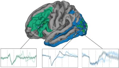 Epic Brain Showdown Reveals Surprising Origins of Human Consciousness