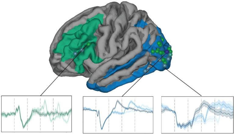 Epic Brain Showdown Reveals Surprising Origins of Human Consciousness