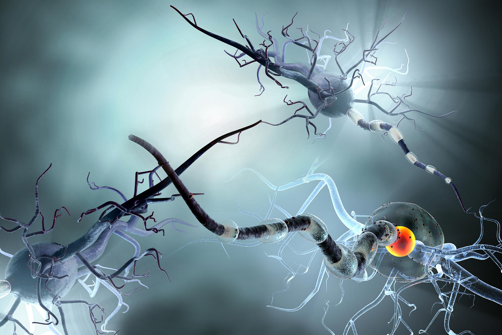 Experts: Coordinated Action Needed to Avert a Brain Disease Crisis