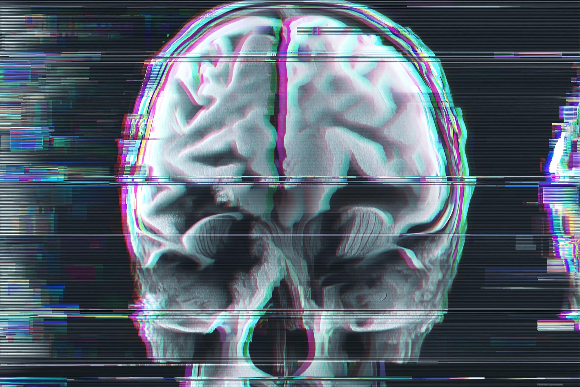 Eight Drinks a Week? Here’s What That Does to Your Brain Over Time