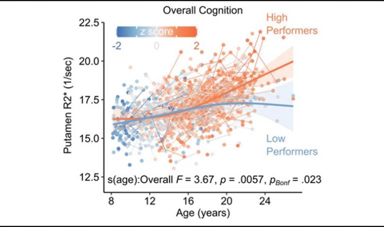 New Research Shows the Brain May Need Iron for Healthy Cognitive ...