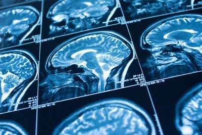 What’s Missing in the Psychopathic Brain? Scientists Find Startling Clues