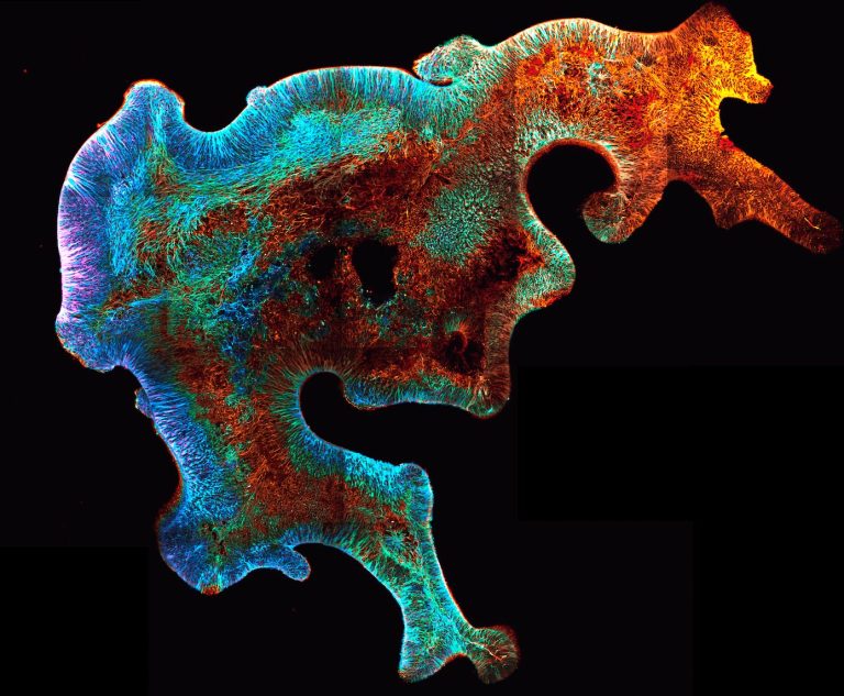 Brain Mimics in a Dish: The Dawn of Next-Gen Organoids to Model ...