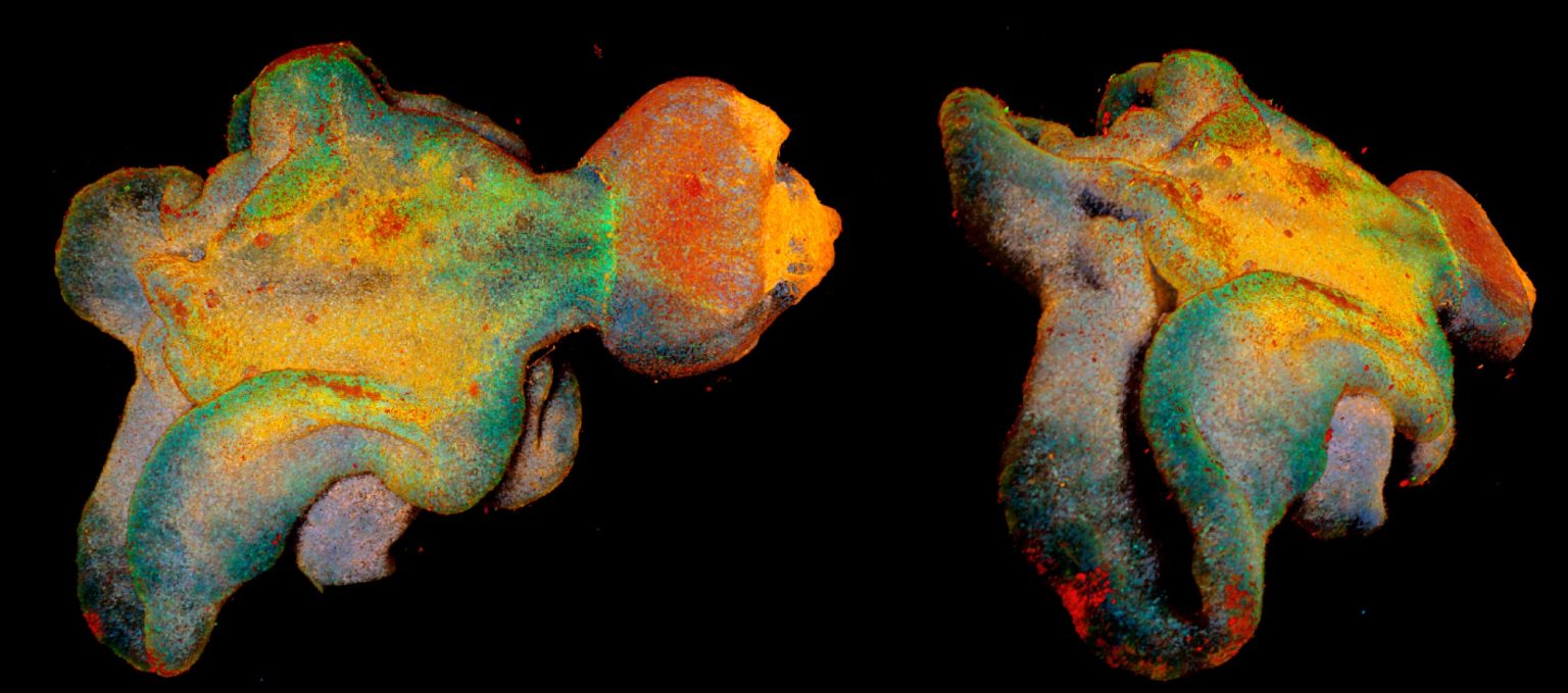 Brain Mimics in a Dish: The Dawn of Next-Gen Organoids to Model ...