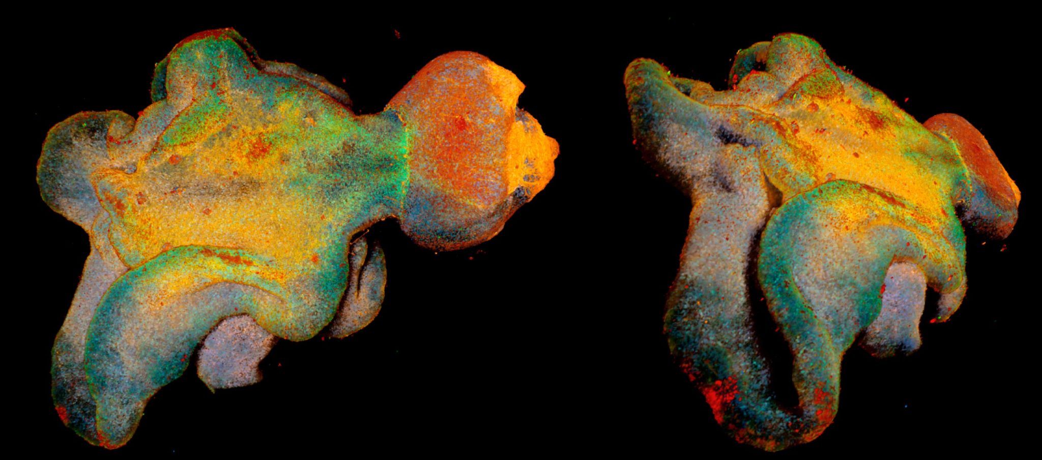 Brain Mimics in a Dish: The Dawn of Next-Gen Organoids to Model ...