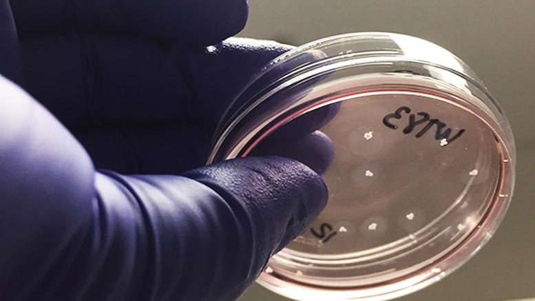 Human Brain Organoids Grown in Lab With “Eyes” That Respond to Light