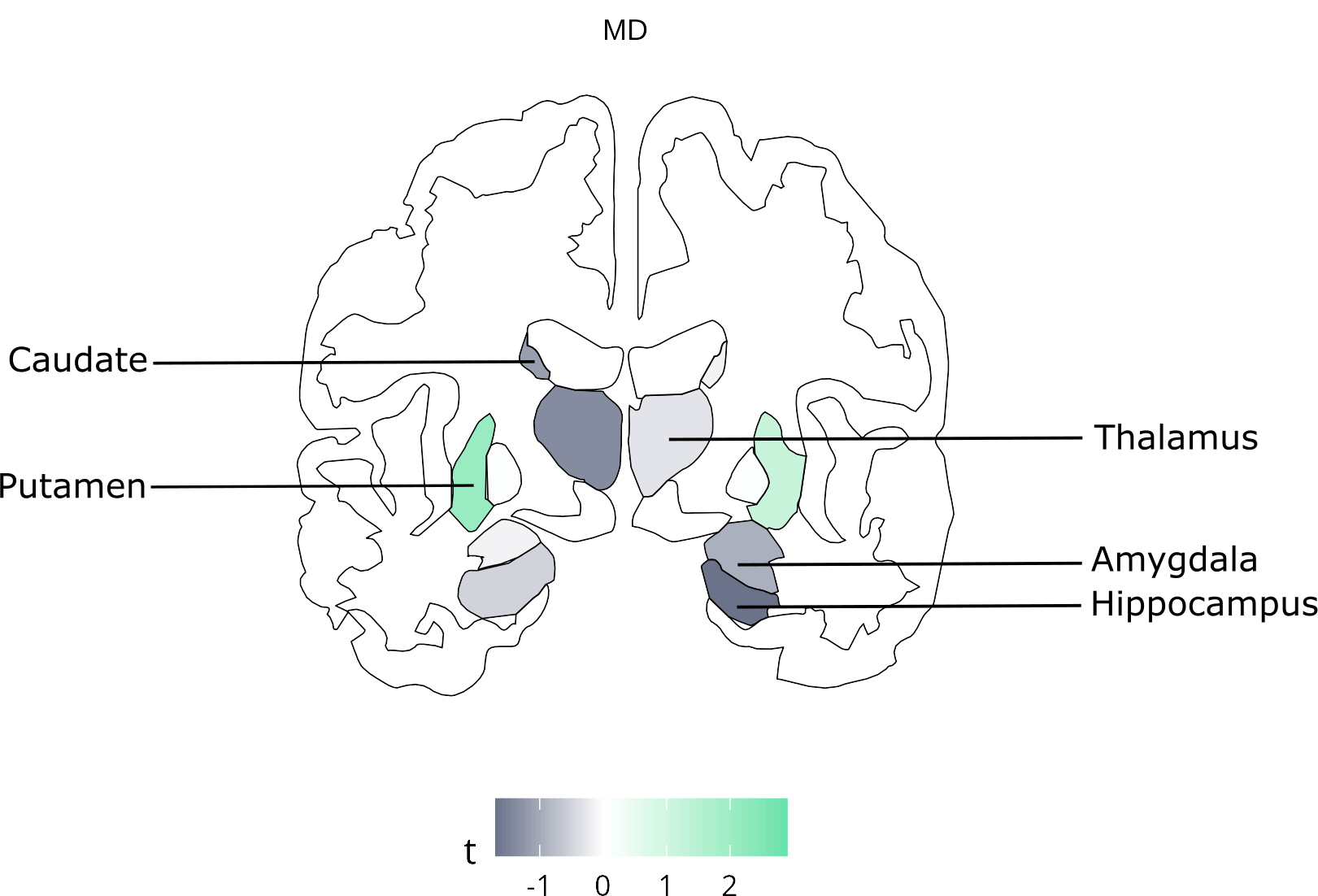 30,000 Brain Scans Reveal a Hidden Danger in Ultra-Processed Foods
