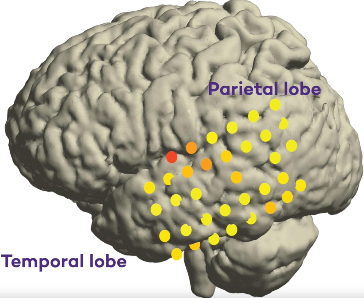 Lost for Words? Scientists Decode the Brain’s Hidden Speech Signals