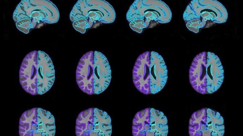 A New Complete, High-Resolution 3D Map of the Mouse Brain [Video]