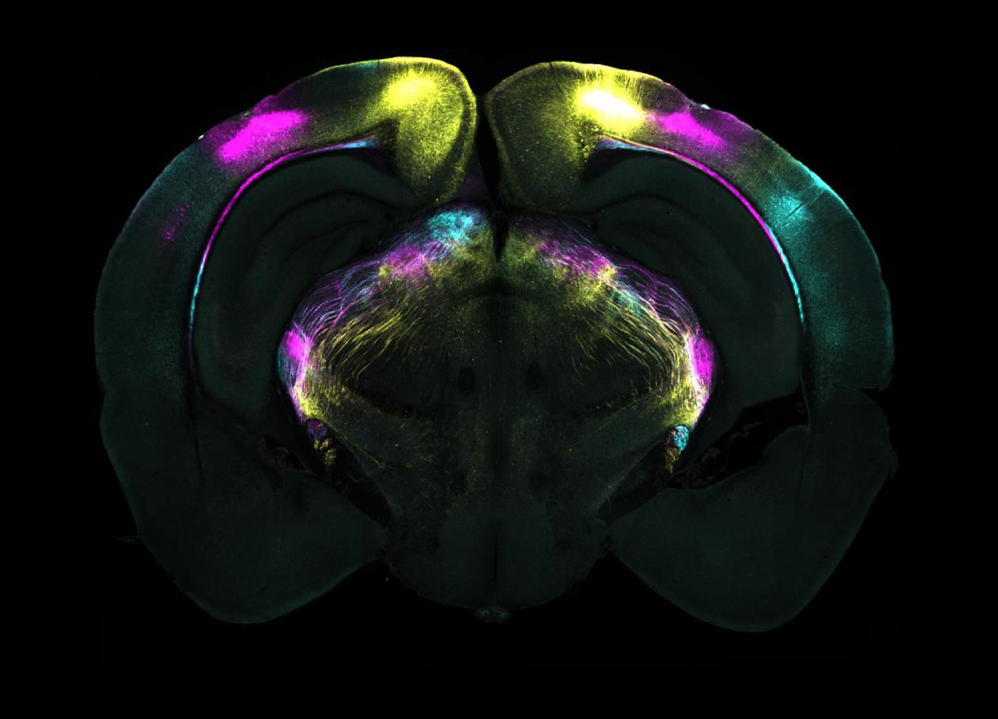 Your Brain’s Hidden Off Switch for Fear Revealed