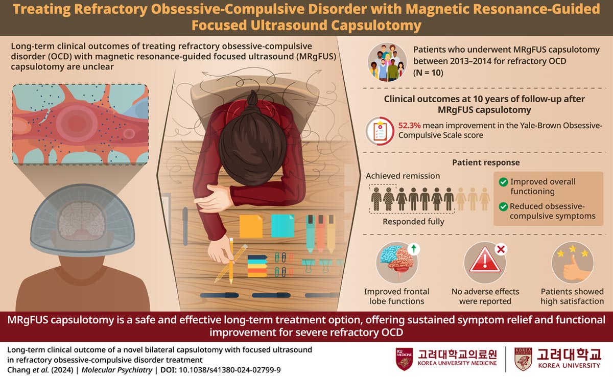 Revolutionary Ultrasound Surgery Offers Long-Term Relief From Severe OCD