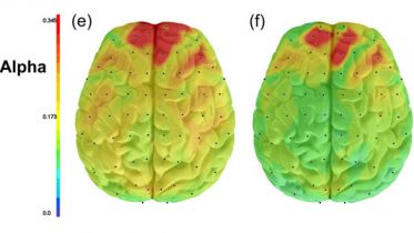 How The Anatomical Structure Of The Brain Impacts Its Functioning How The Anatomical Structure Of The Brain Impacts Its Functioning