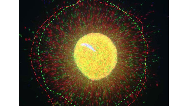 Researchers Discover Human-Specific Gene for Building a Bigger Brain