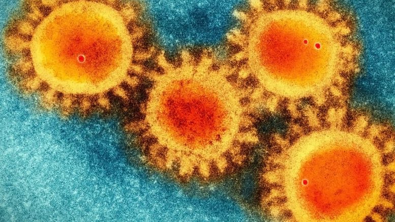 SARS vs. COVID-19: Why Some Coronavirus Strains Are More Infectious ...