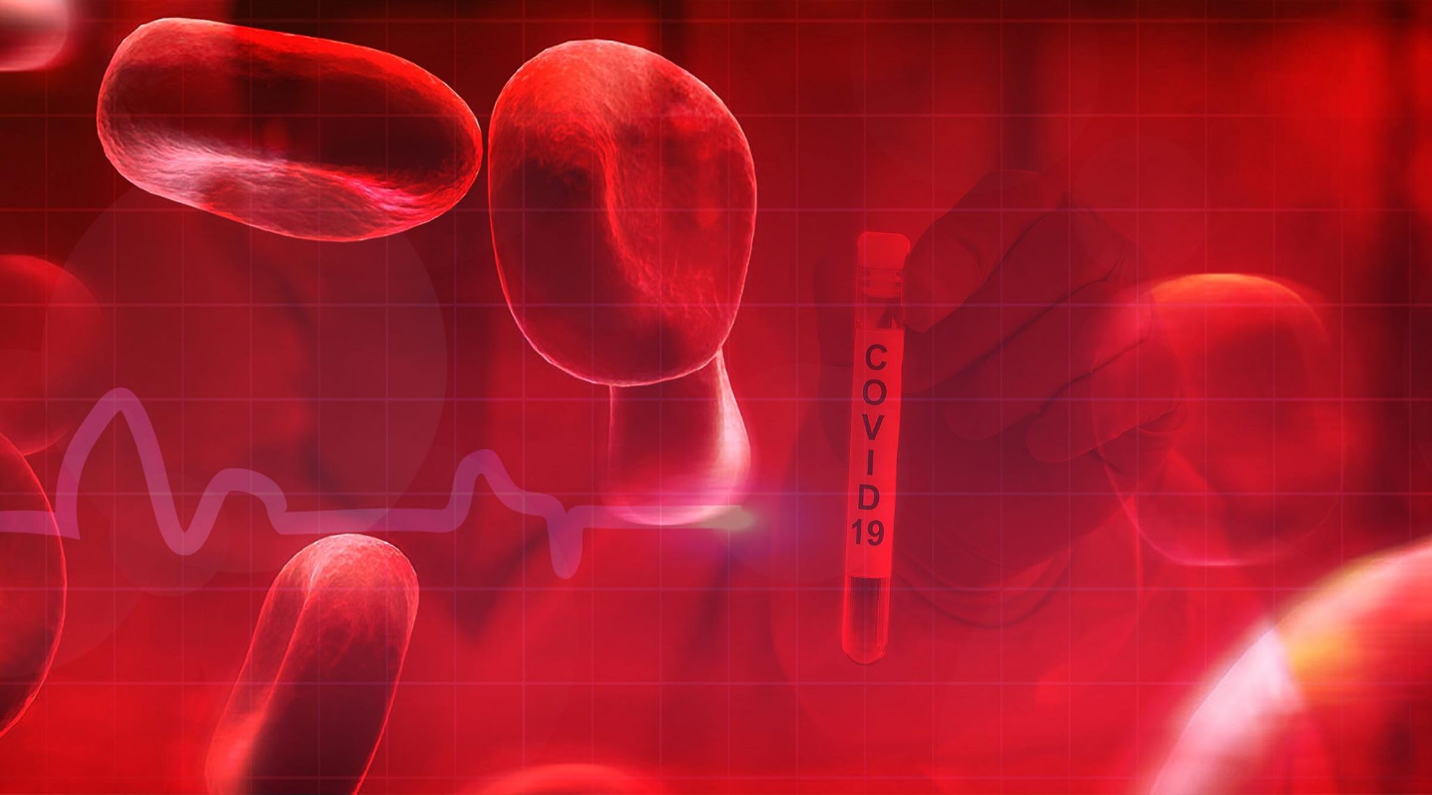 Secondary Bloodstream Infections Associated With Severe COVID-19 and ...