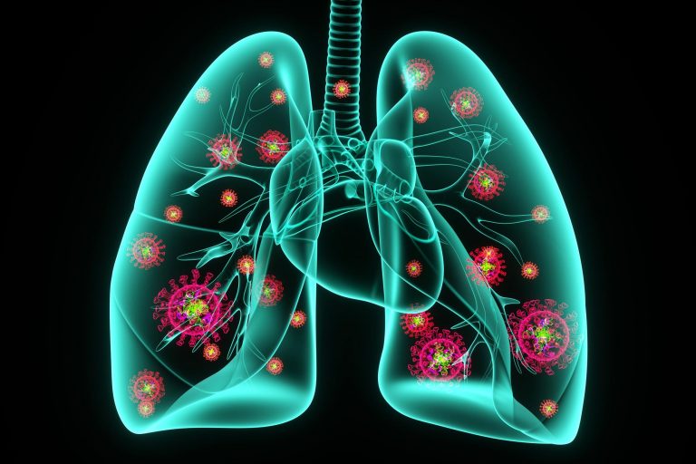Long COVID-19 May Stem From an Overactive Immune Response in the Lungs