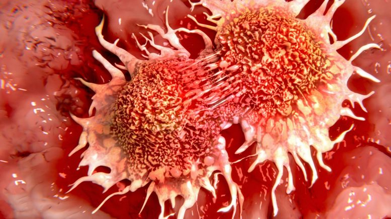 Researchers Discover Proteins Responsible for Cancer Cell Movement