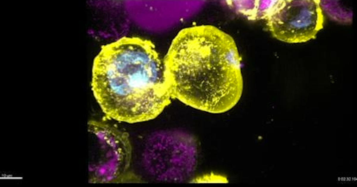 “Explosive” Cell Death – Scientists Discover Genetic Trigger in 3% of ...